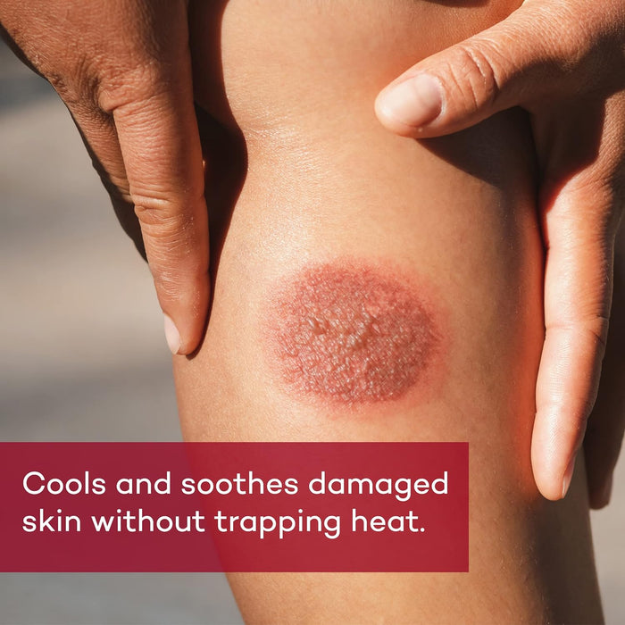 First Aid Burn Gel 0.9g Packs for Minor Burns, Cuts, and Scrapes ...